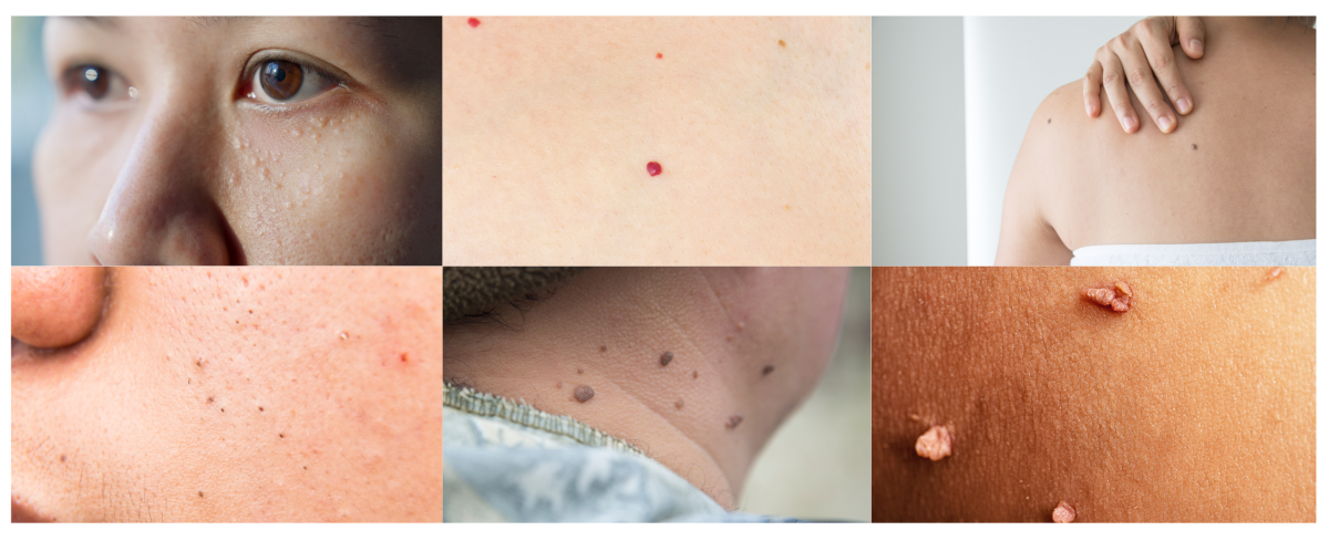 Skin Therapy - The International Health Centre The Hague